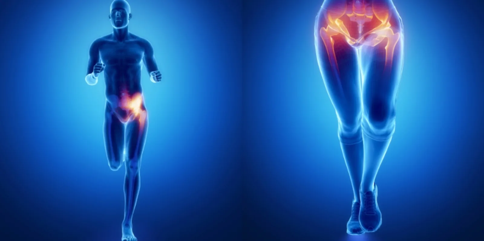 Dolore all’interno coscia, come capire se è pubalgia - Semplicemente Salute